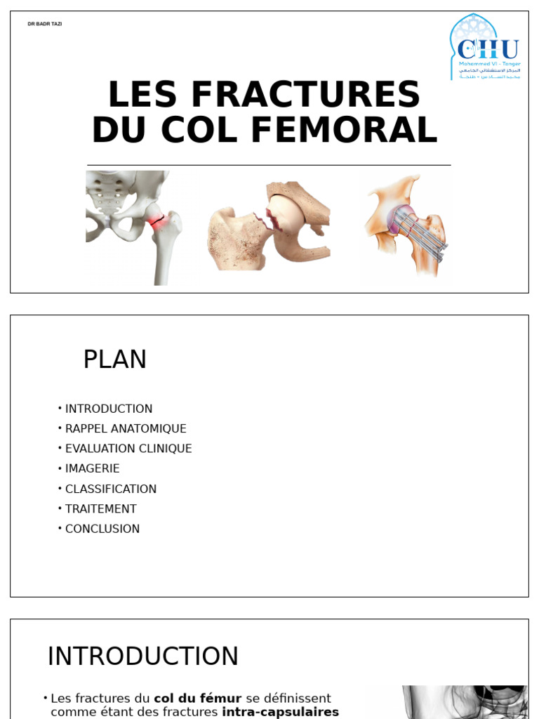Les Fractures Du Col Femoral | PDF | Appareil locomoteur | Médecine ...