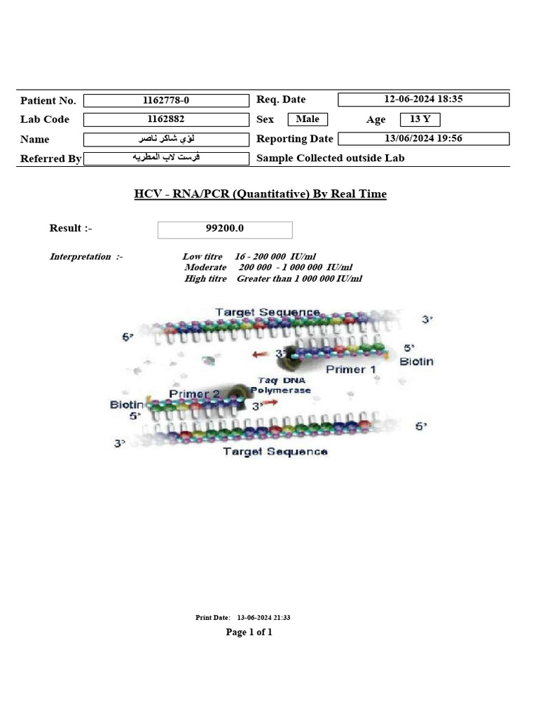 HCV - RNA/PCR (Quantitative) by Real Time: 1162882 12-06-2024 18:35 ...