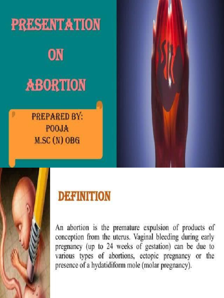 Abortion | PDF