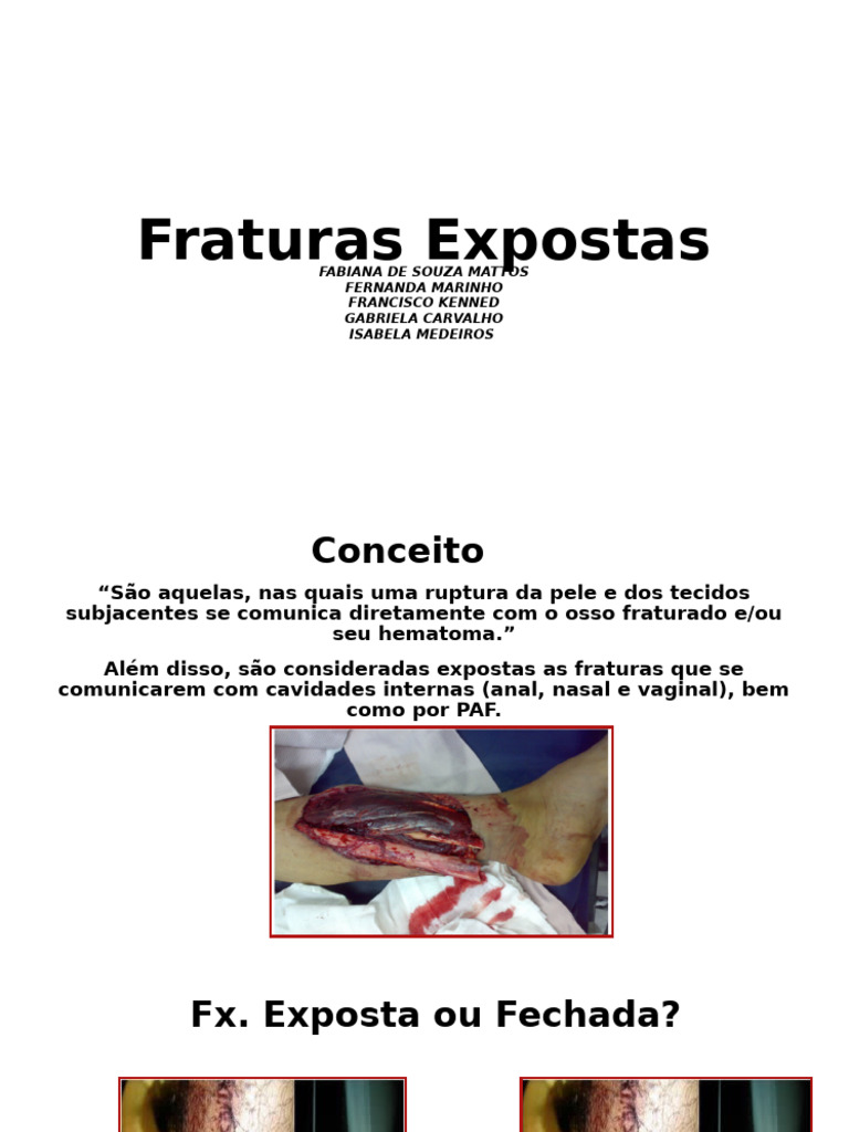 Cópia de Fraturas Expostas | PDF | Medicina Clínica | Especialidades ...