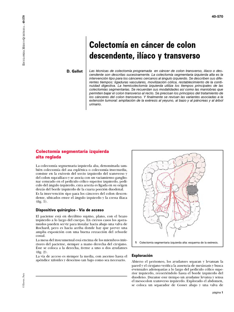 Colectomia Izquierda Trasversa | PDF | Intestino grueso | Cáncer