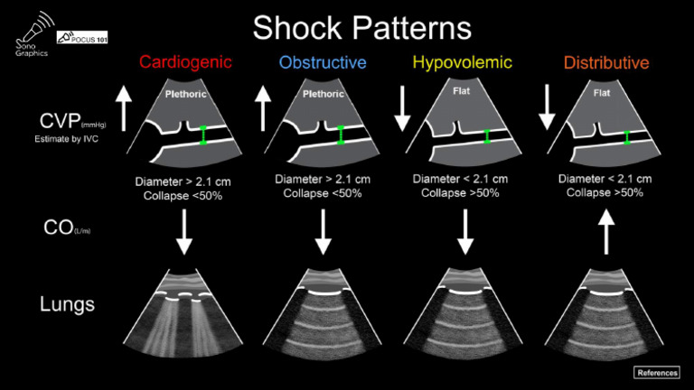 Shock Patterns | PDF
