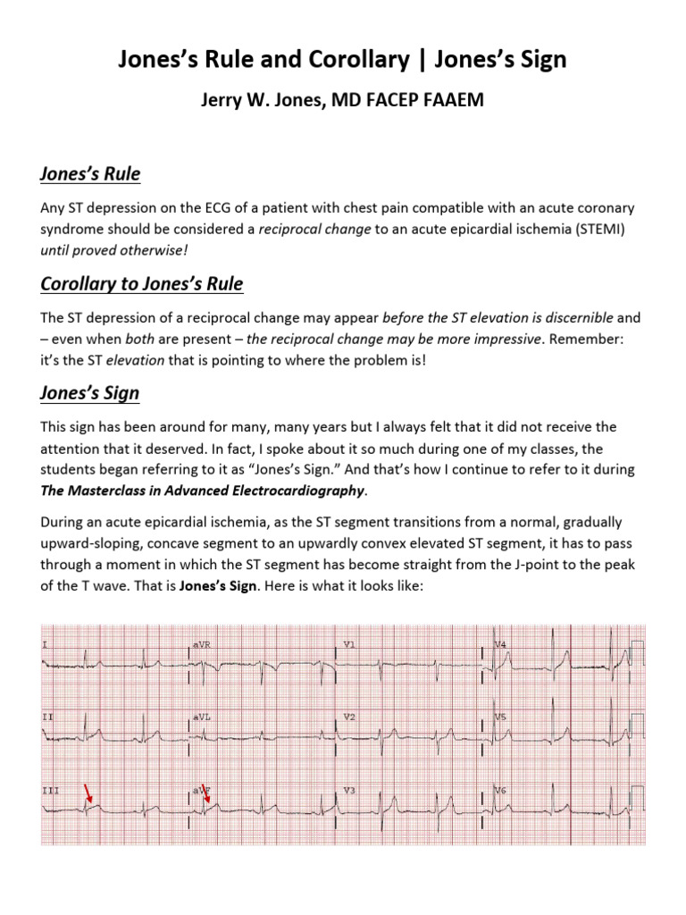 Joness Rule and Corollary Joness Sign | PDF | Electrocardiography ... Joness Rule and Corollary Joness Sign | PDF | Electrocardiography ...