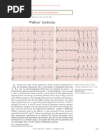 Understanding Wellens Syndrome ECG Patterns | PDF | Electrocardiography ...