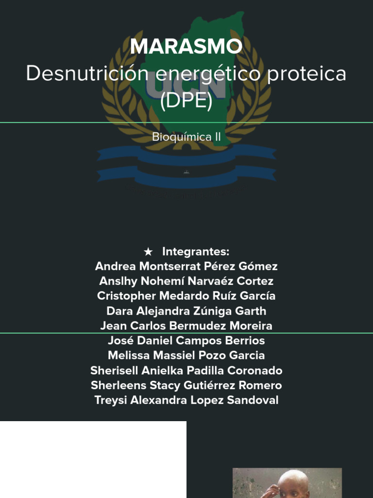 MARASMO Desnutrición Energético Proteica | PDF | Desnutrición | Nutrición
