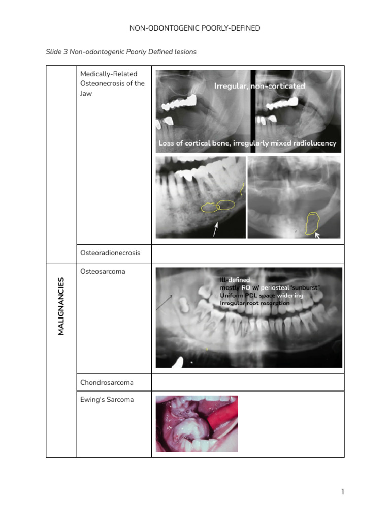 L7 Non-Odontogenic Poorly Defined | PDF | Metastasis | Bone