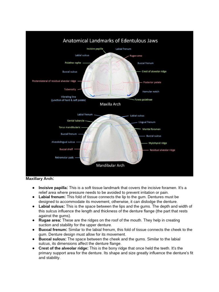 Edentulous cast labeled | PDF | Dentures | Tongue