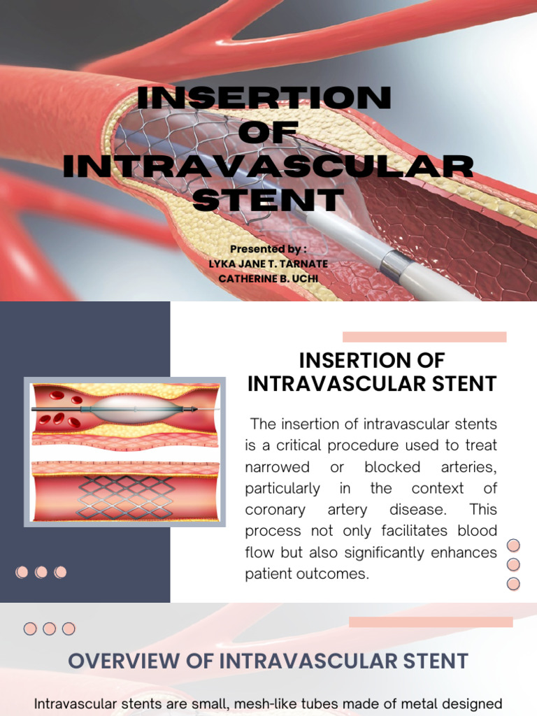 INSERTION OF INTRAVASCULAR STENT-(TARNATE, LYKA JANE & UCHI, CATHERINE) | PDF | Stent ...