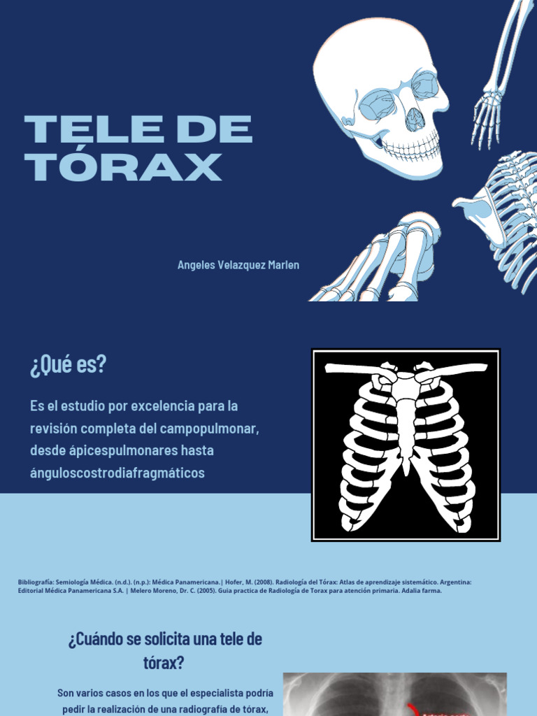 Tele de tórax | PDF | Tórax | Radiología