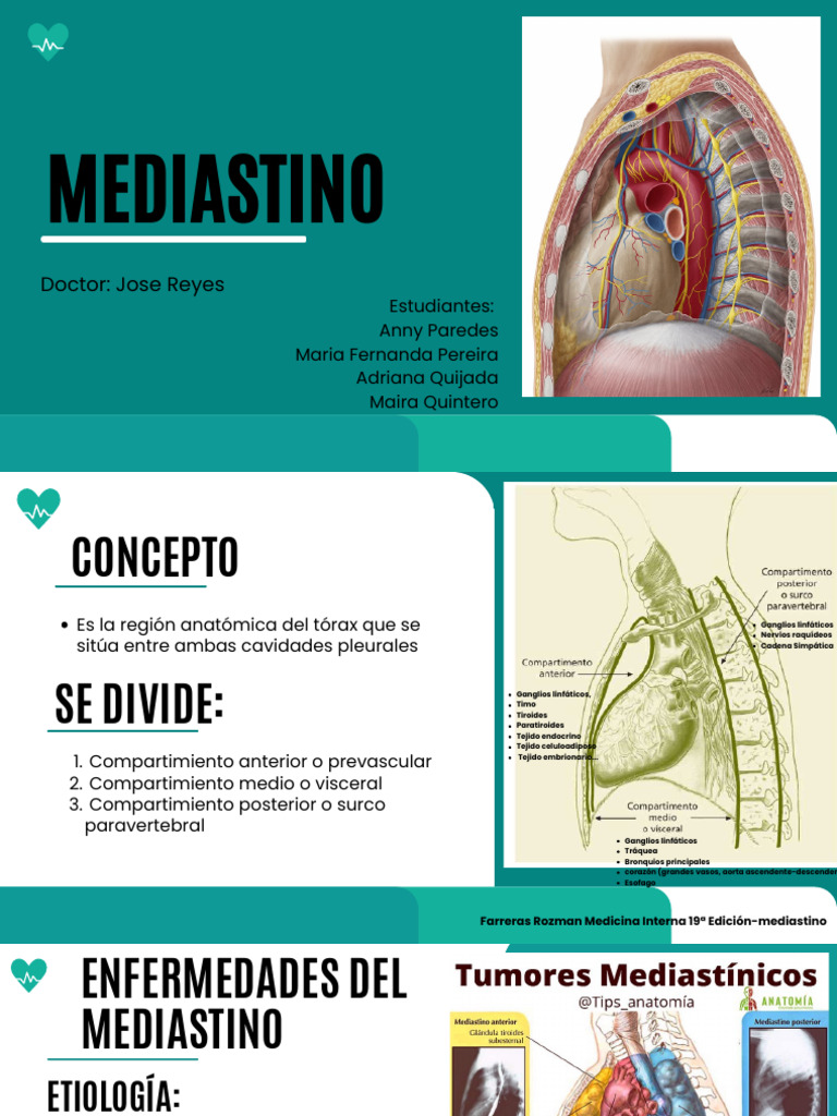 Mediastino | PDF | Neoplasias | Anatomía