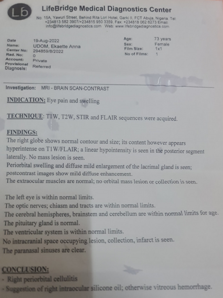 MRI Brain Scan Report | PDF