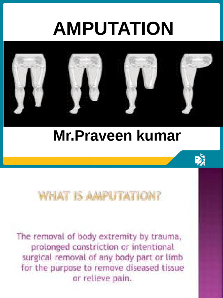Amputation | PDF