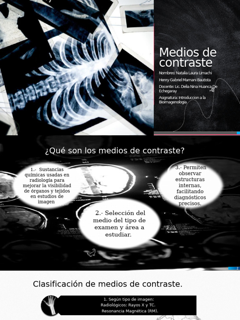 Medios de Contraste | PDF | Inyección (medicina) | Radiología