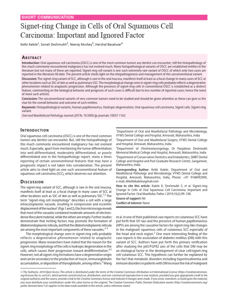 Signet ring variant of OSCC | PDF | Squamous Cell Carcinoma | Carcinoma
