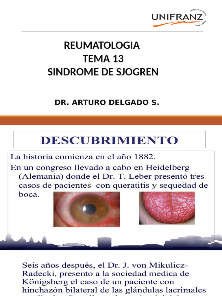 Sindrome de Sjogren t13 | PDF