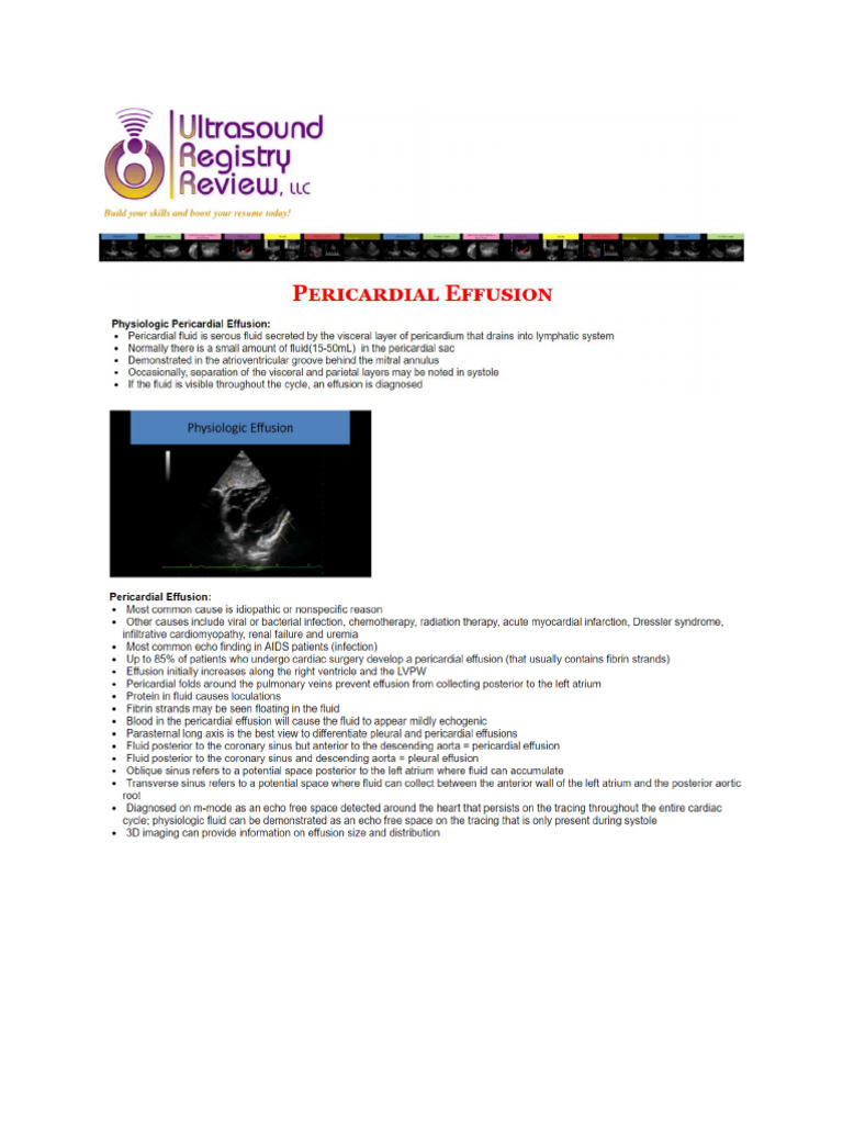USRR Pericardial Effusion | PDF
