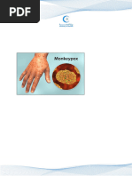 Mpox Presentation | PDF | Influenza | Self-Improvement