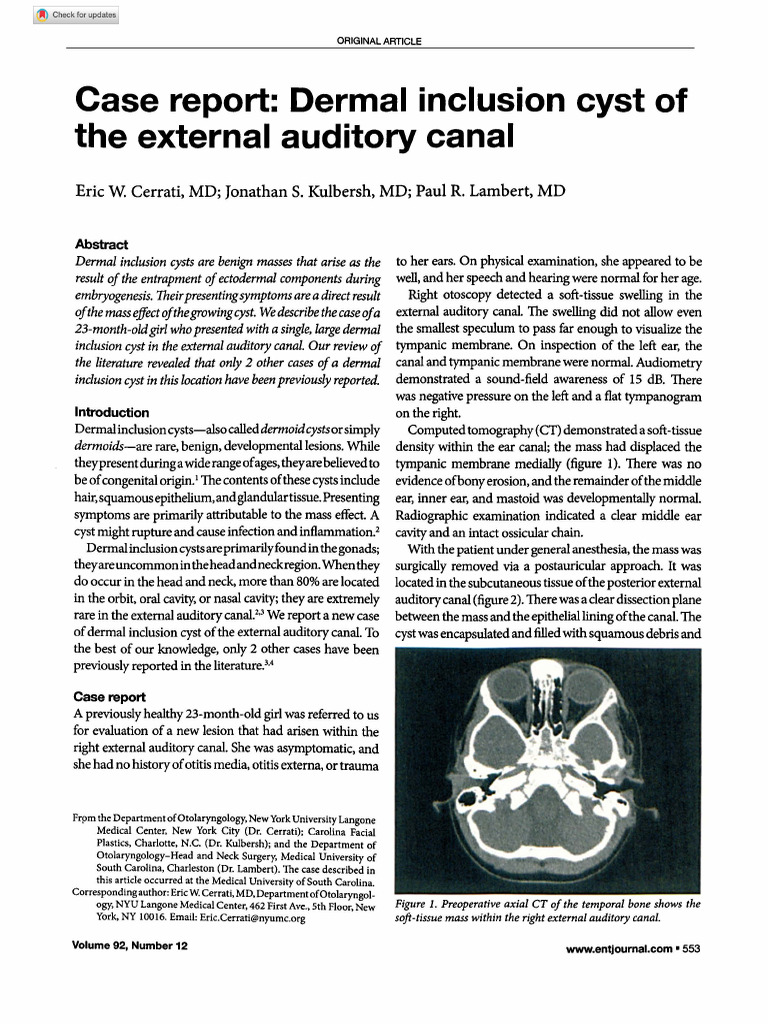 Cerrati Et Al 2013 Case Report Dermal Inclusion Cyst of The External ...