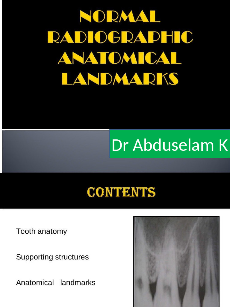 Maxilla Bone Landmarks Guide | PDF