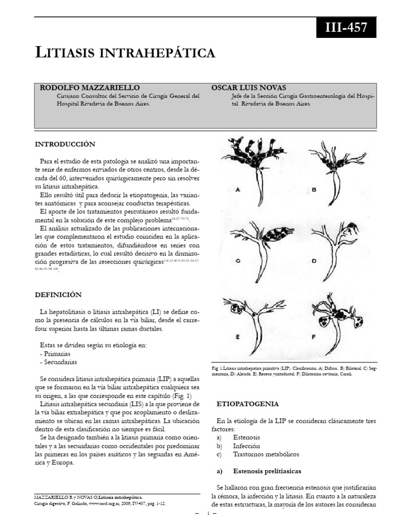 Clasificación de Litiasis Intrahepática | PDF | Hígado | Abdomen