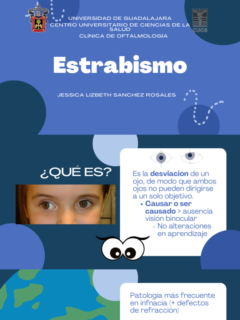 Estrabismo Presentación | PDF | Sistema visual | Ojo humano