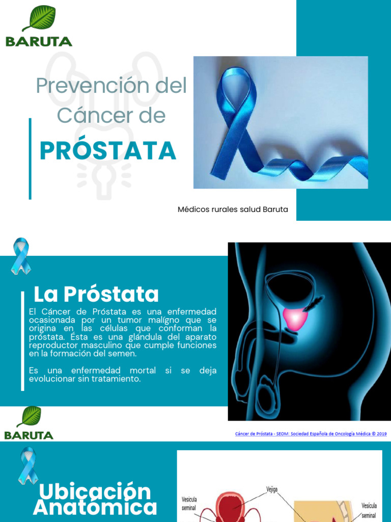 CA de Prostata | PDF | Cancer de prostata | Próstata