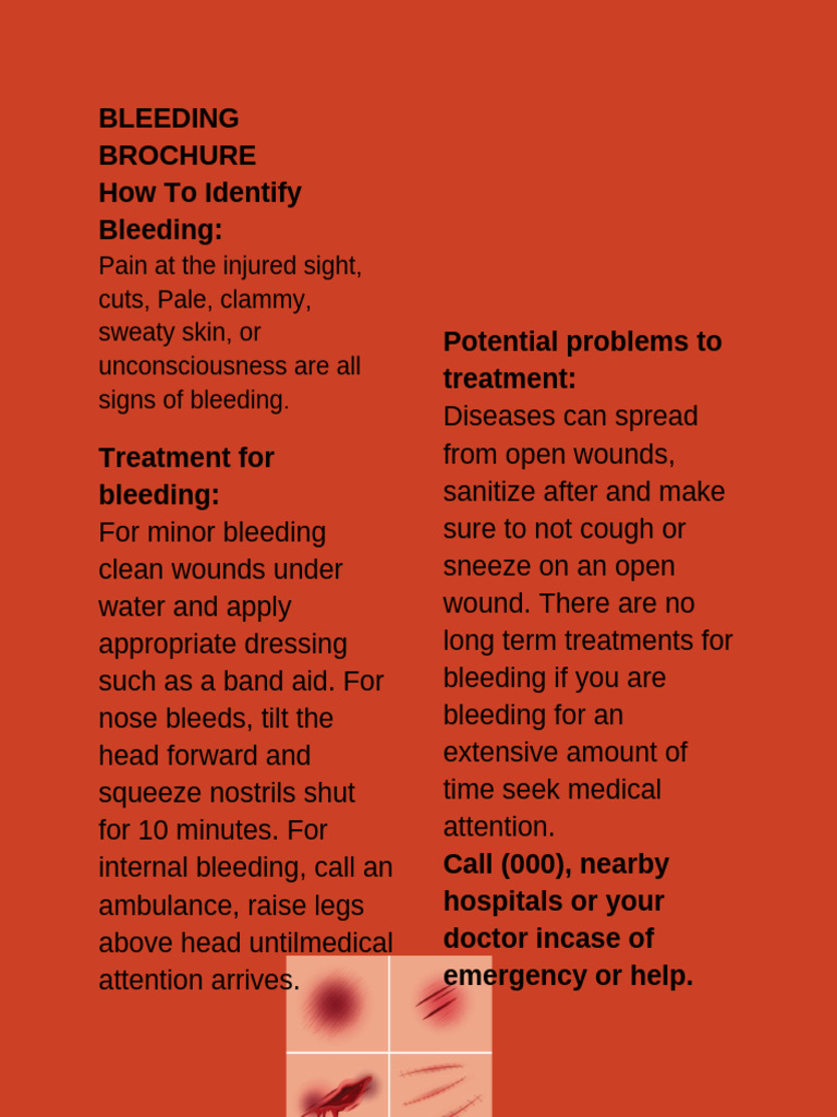 BLEEDING BROCHURE How To Identify Bleeding | PDF