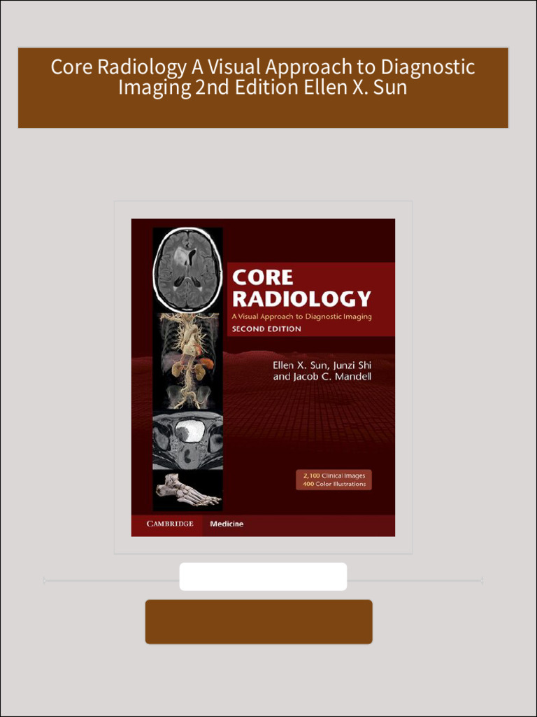 Full Download Core Radiology A Visual Approach To Diagnostic Imaging ...