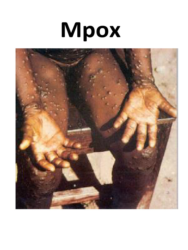 Mpox en image | PDF