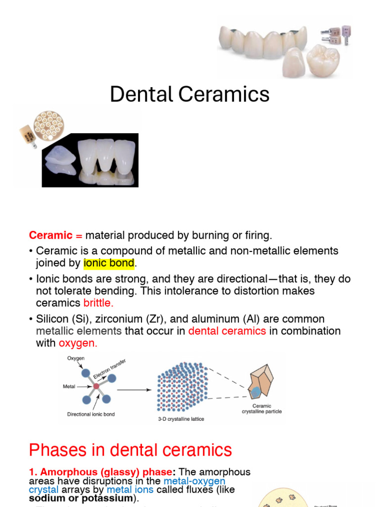 Dental Ceramics for Professionals | PDF | Ceramics | Materials