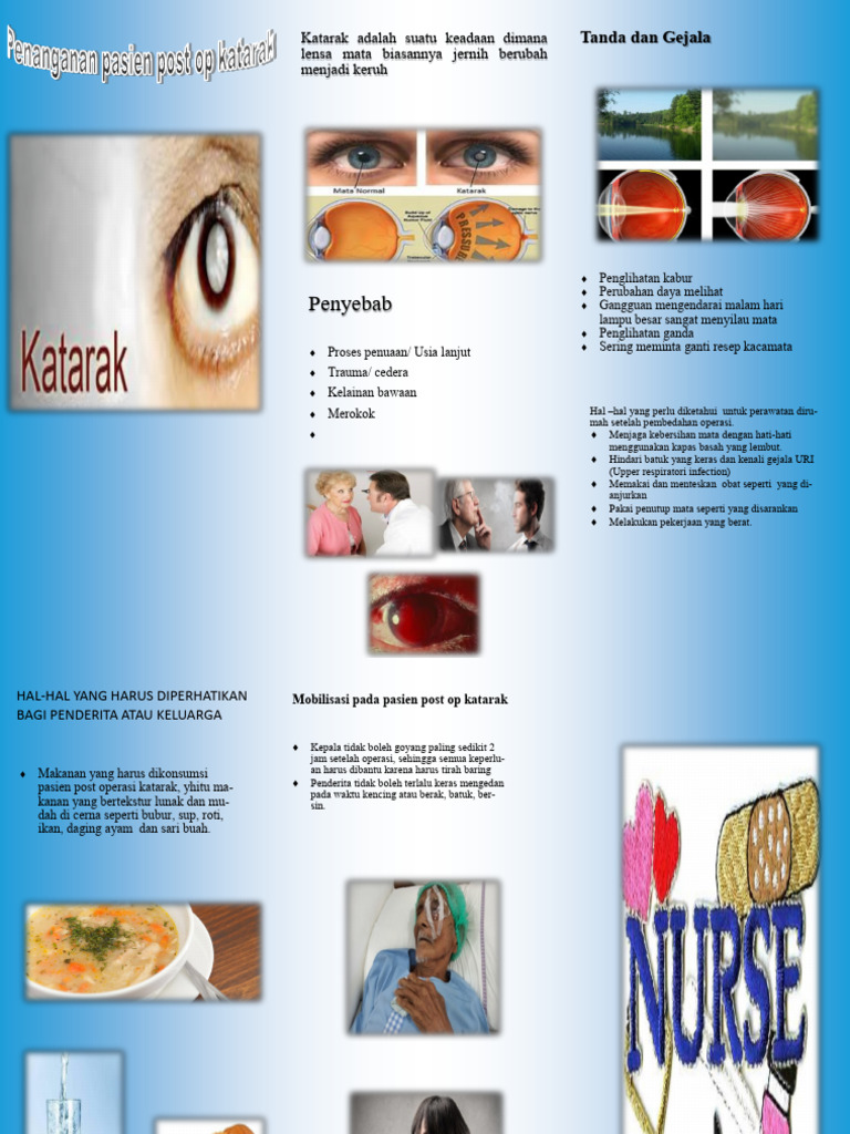 Leaflet Katarak | PDF