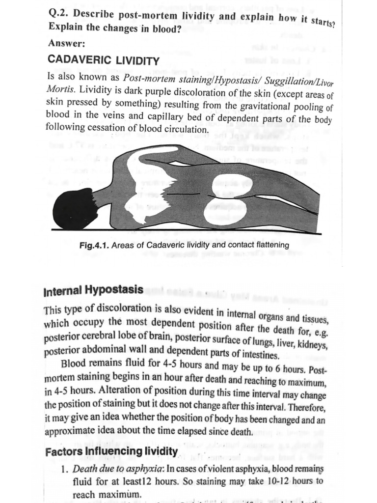 Cadaveric Lividity | PDF