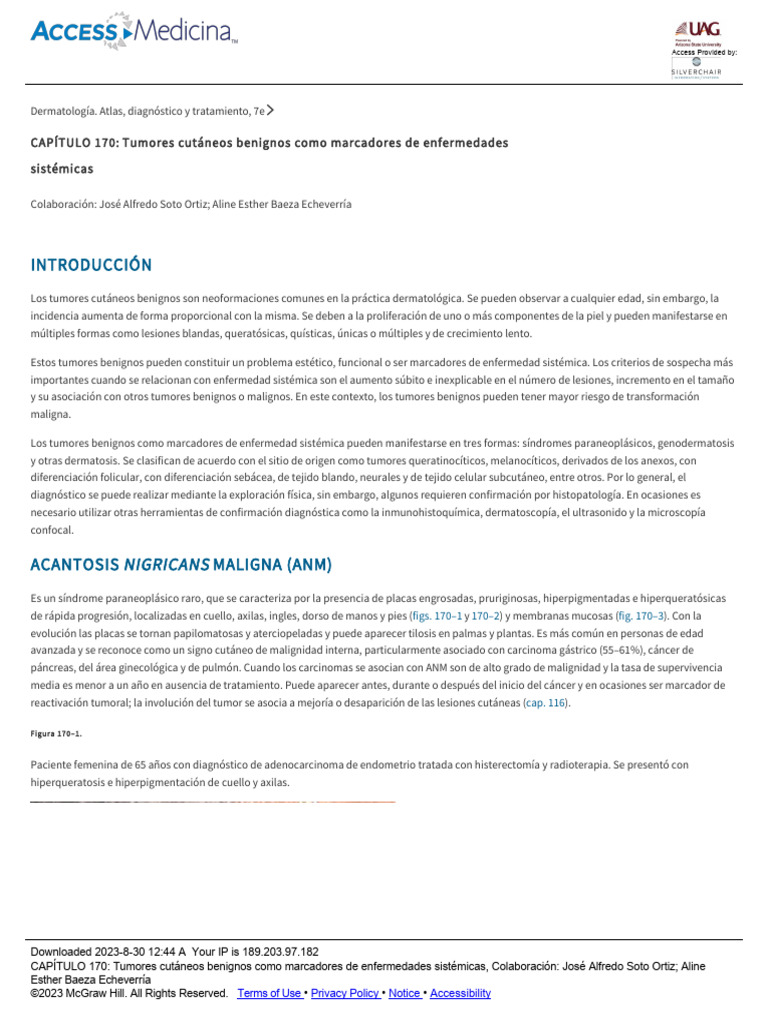CAPÍTULO 170_ Tumores cutáneos benignos como marcadores de enfermedades sistémicas | PDF ...