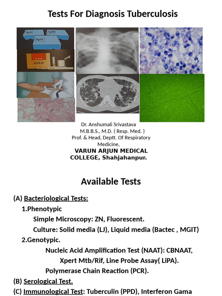 CT 1.12 Tests For Diagnosis Tuberculosis | PDF | Tuberculosis ...