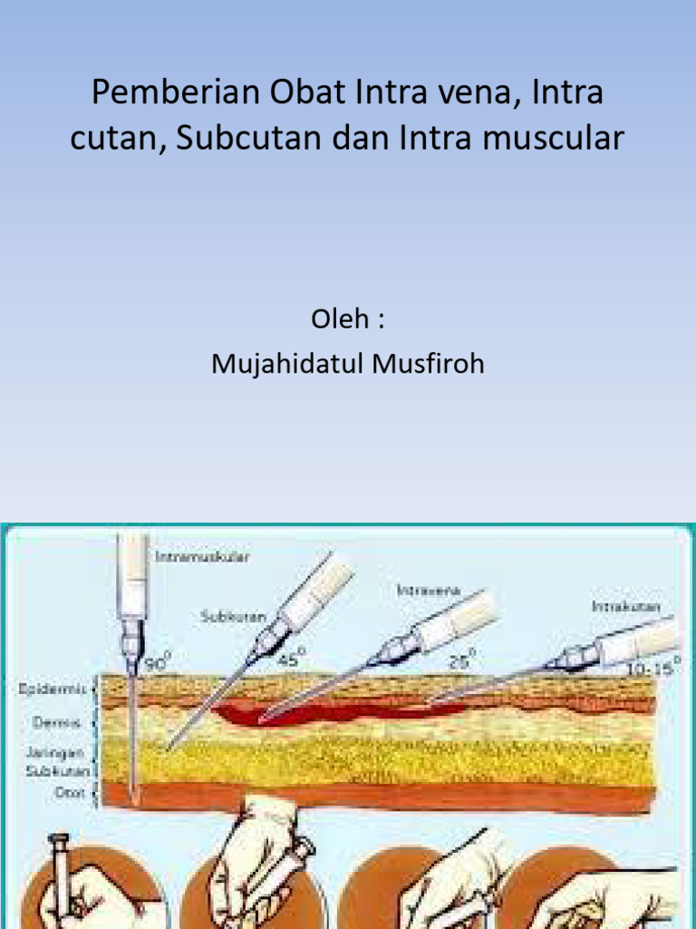 Pemberian Obat IV, IC, SC, IM | PDF
