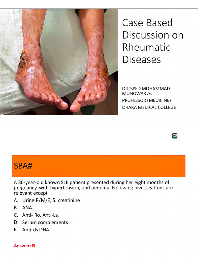 Rheumatic Disease Monowar Ali Sir - 1 | PDF