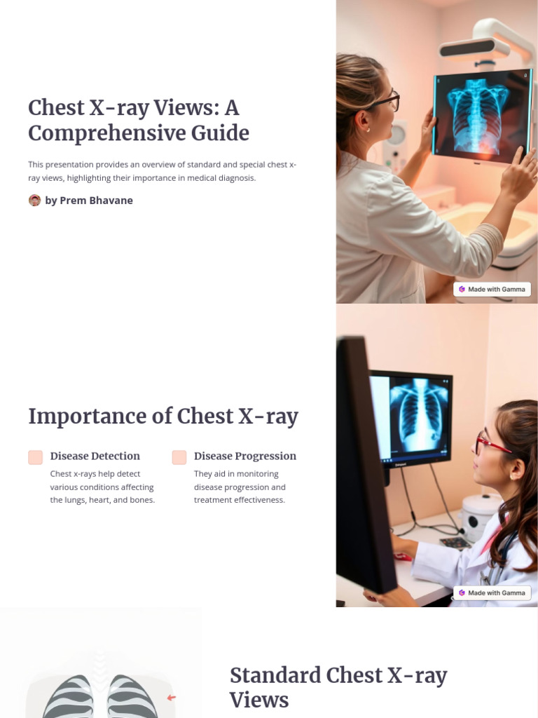 Chest X Ray Views A Comprehensive Guide | PDF | X Ray | Clinical Medicine