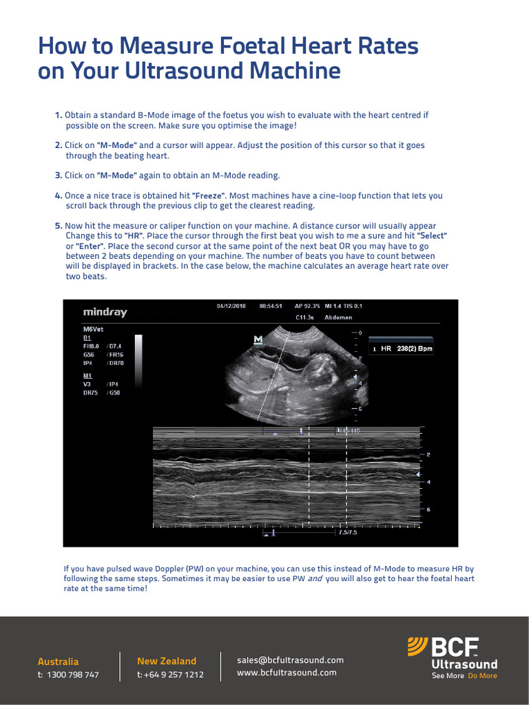 How_to_Measure_Foetal_Heart_Rates | PDF