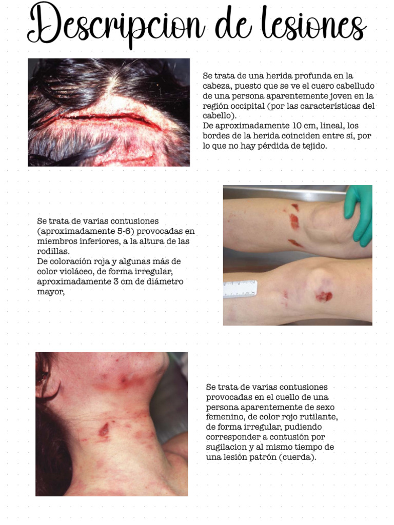 Descripción de Lesiones | PDF