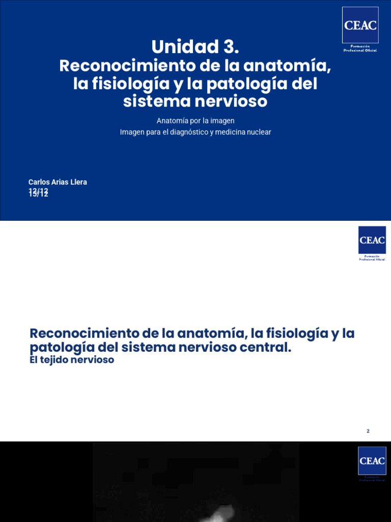 Sistema Nervioso y Ã Rganos de Los Sentidos | PDF | Sinapsis | Sistema nervioso central