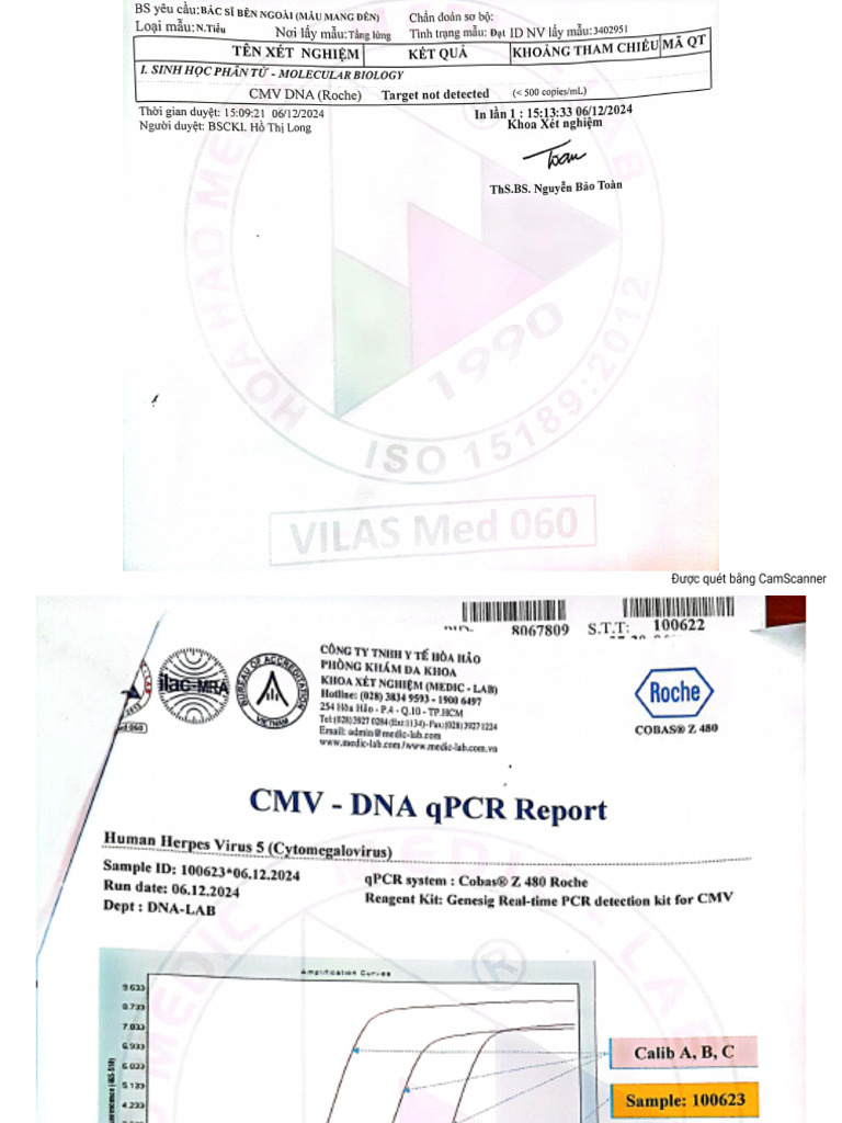 Xet Nghiem CMV-EBV-Lao | PDF