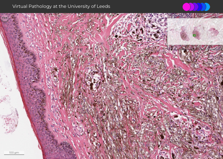 Slide Viewer Virtual Pathology at the University of Leeds 6 | PDF