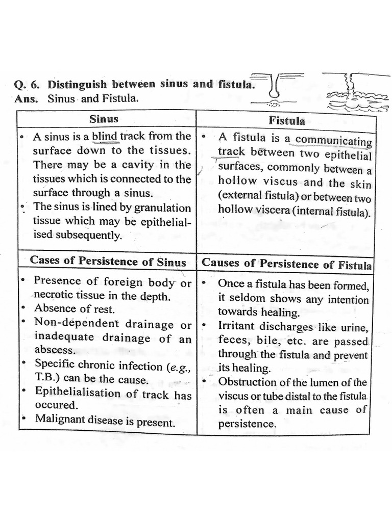 Sinus Vs Fistula | PDF