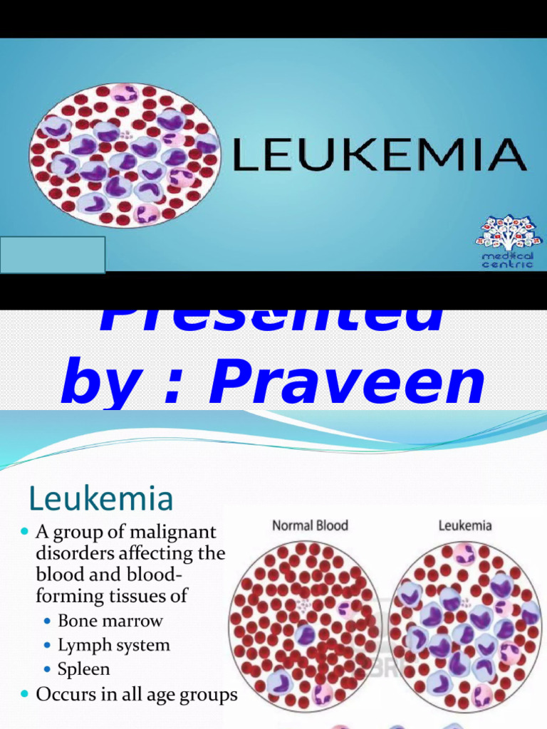 leukaemia | PDF