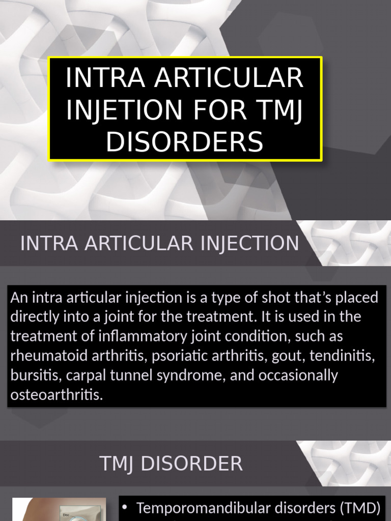 Intra Articular Injection For TMJ Disorders | PDF | Myofascial Trigger ...