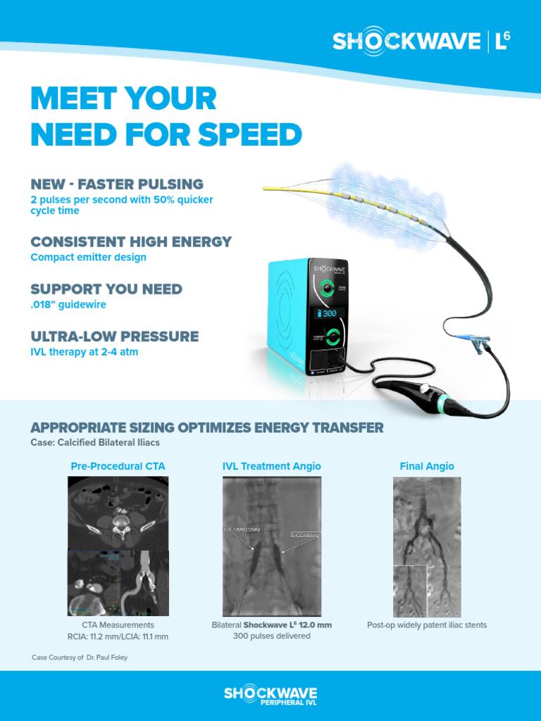 Shockwave L6 - Meet Your Need For Speed | PDF | Cardiovascular System ...