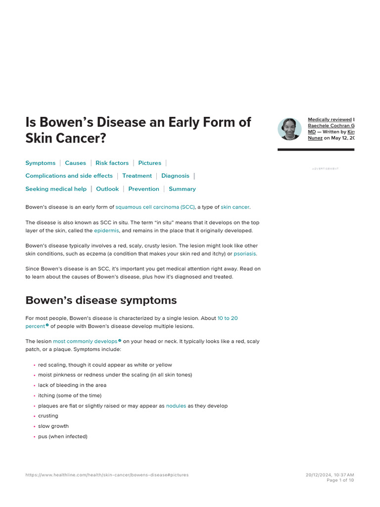 Bowen's Disease Symptoms, Causes, Diagnosis, and Treatment | PDF ...