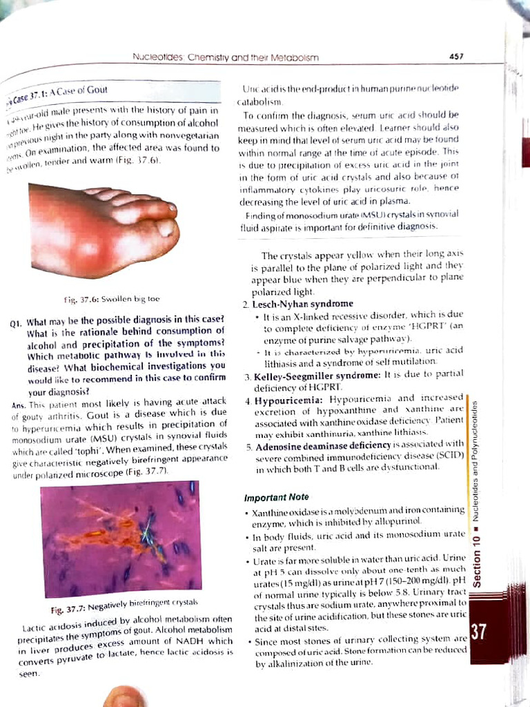 a case of GOUT | PDF | Gout | Metabolism