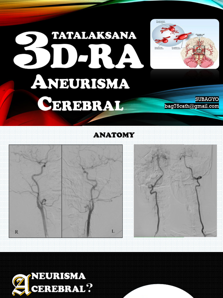 DSA Stroke Aneurisma | PDF