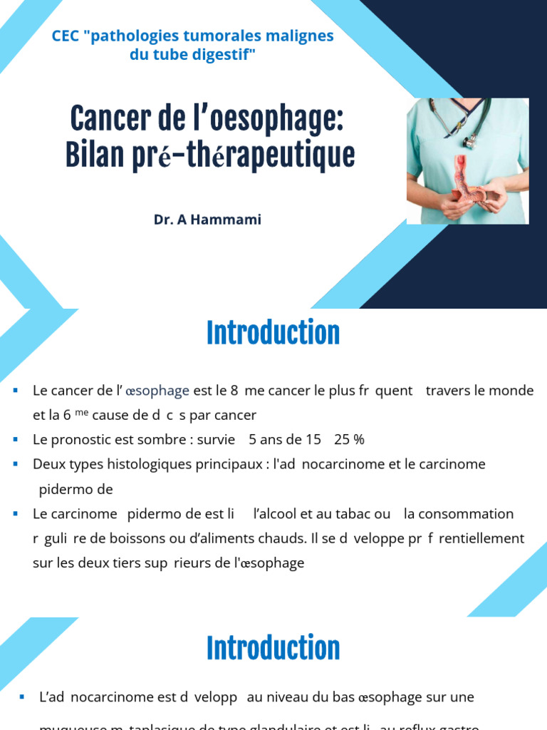 Bilan pré-thérapeutique cancer œsophage | PDF | Cancer de l'œsophage ...